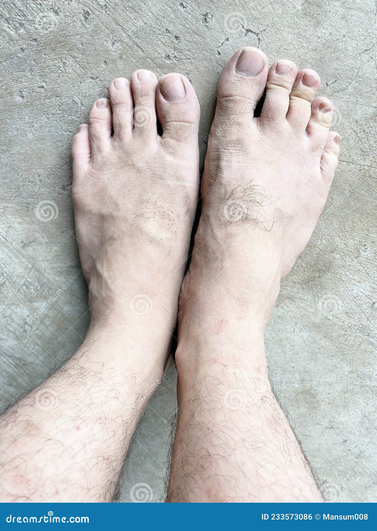 Foot on cement floor stock photo. Image of healthy, person - 233573086