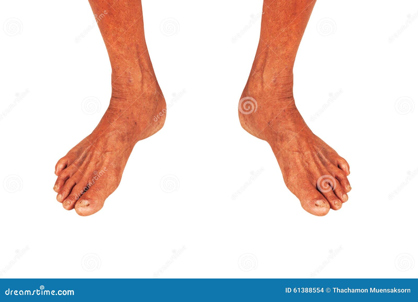 Foot of elderly man stock photo. Image of healthy, human - 61388554