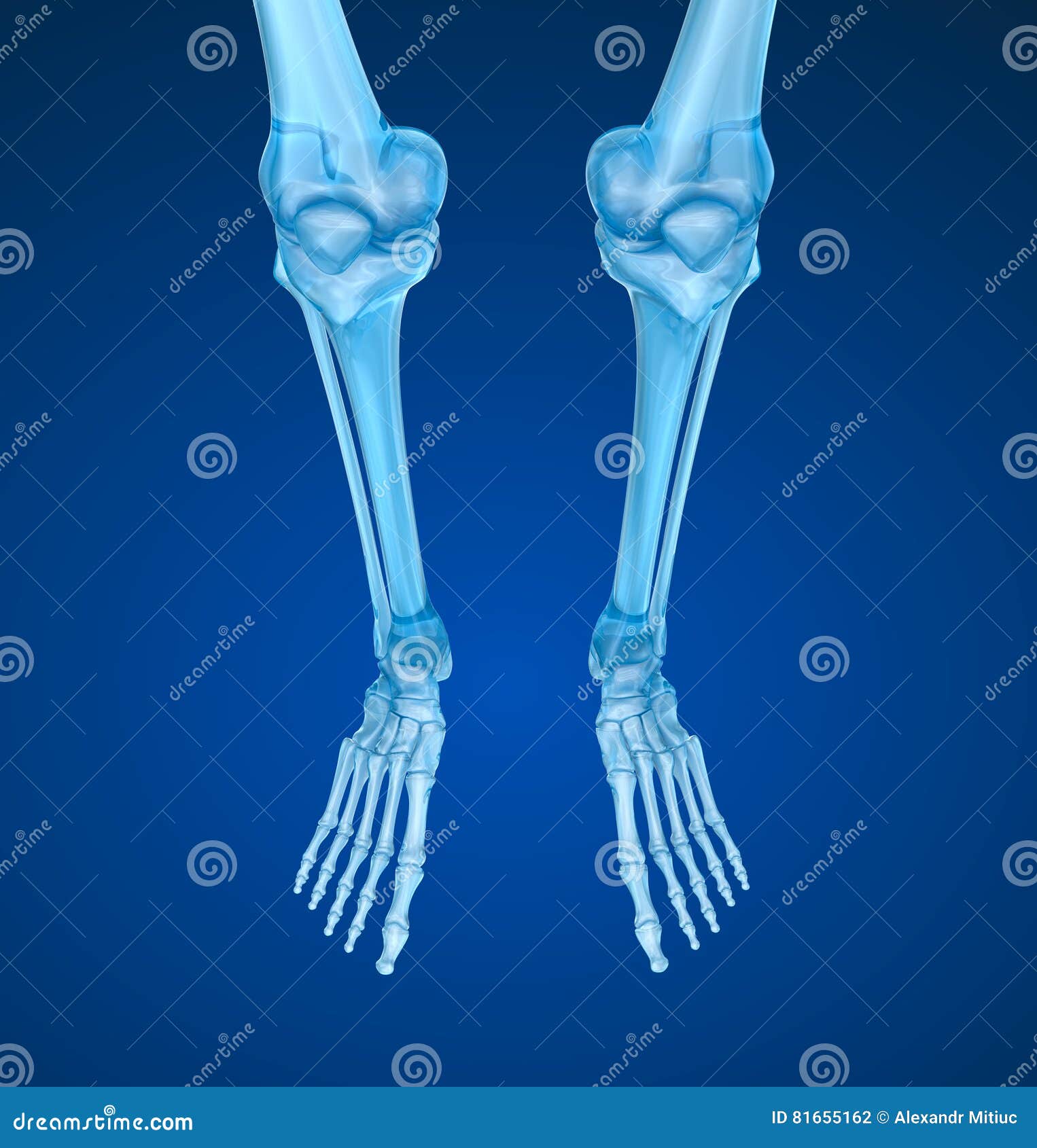 MRI FOOT Scan Sagittal View T2 Fat Suppression Technique For Diagnostic ...