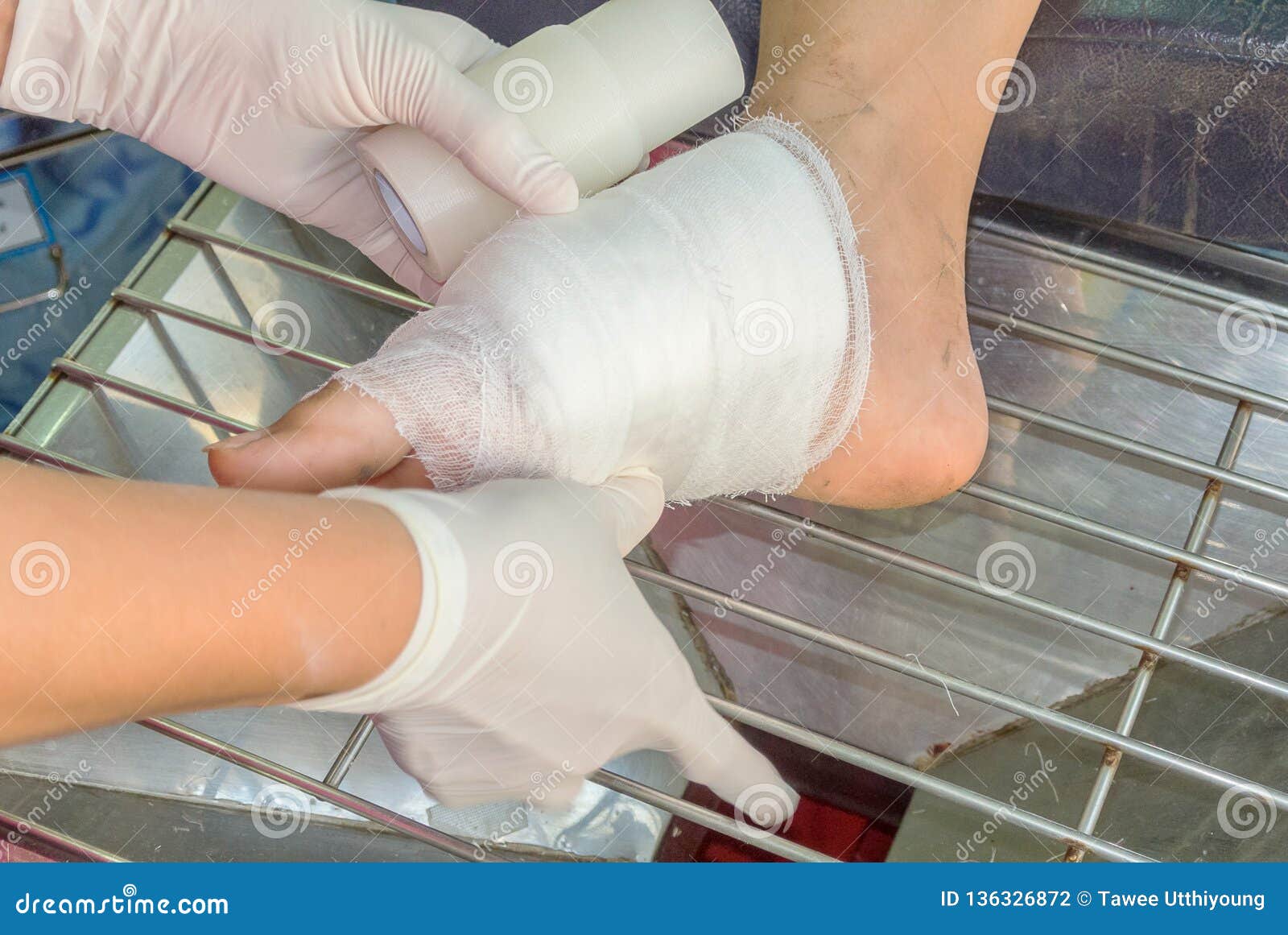 Infected Wound Of Leg Stock Image | CartoonDealer.com #75497431