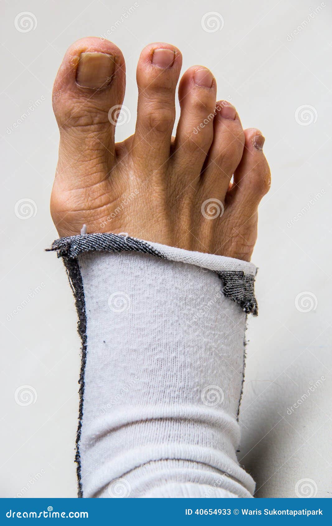 Foot with poor sock stock image. Image of lecture, business - 40654933