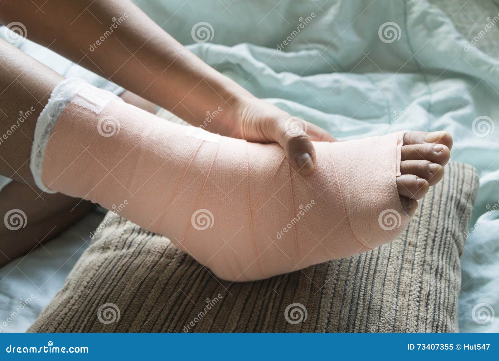 Foot Soft Splint for Treatment of Injuries Stock Image - Image of ...