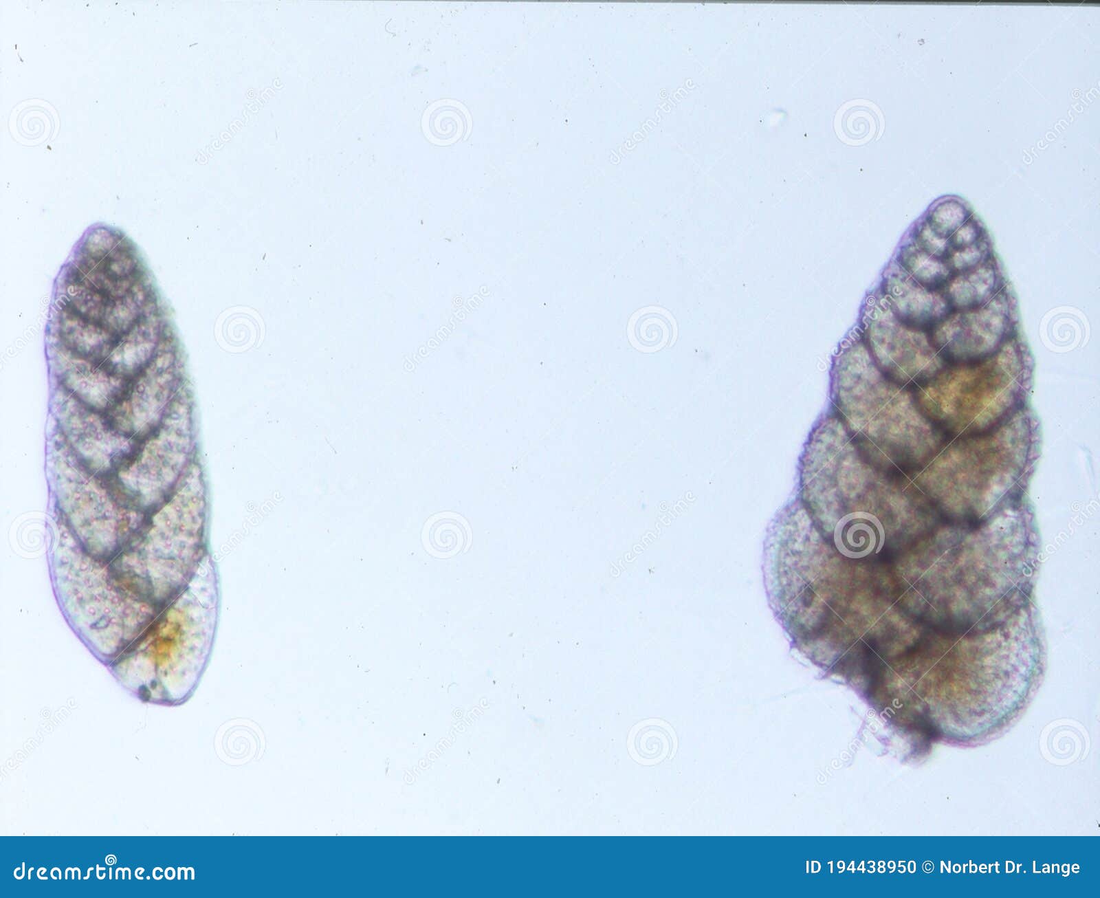 Foraminifera Microorganisms from the Sea Stock Photo - Image of peel ...