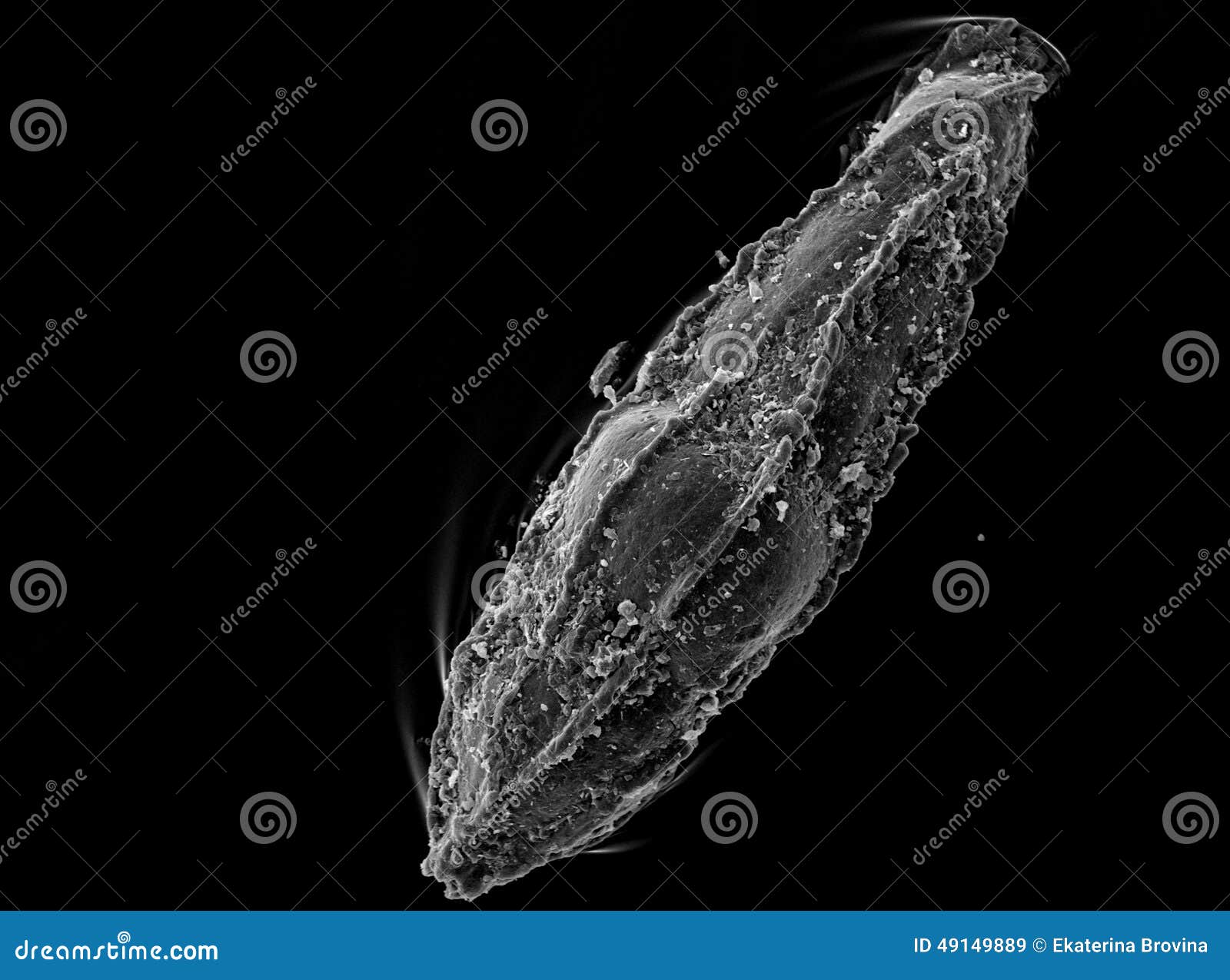 Foraminifera Under Microscope Labeled