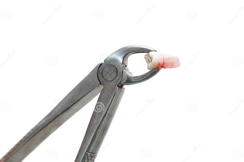 Forceps with Extracted Tooth Stock Photo - Image of stomatology ...