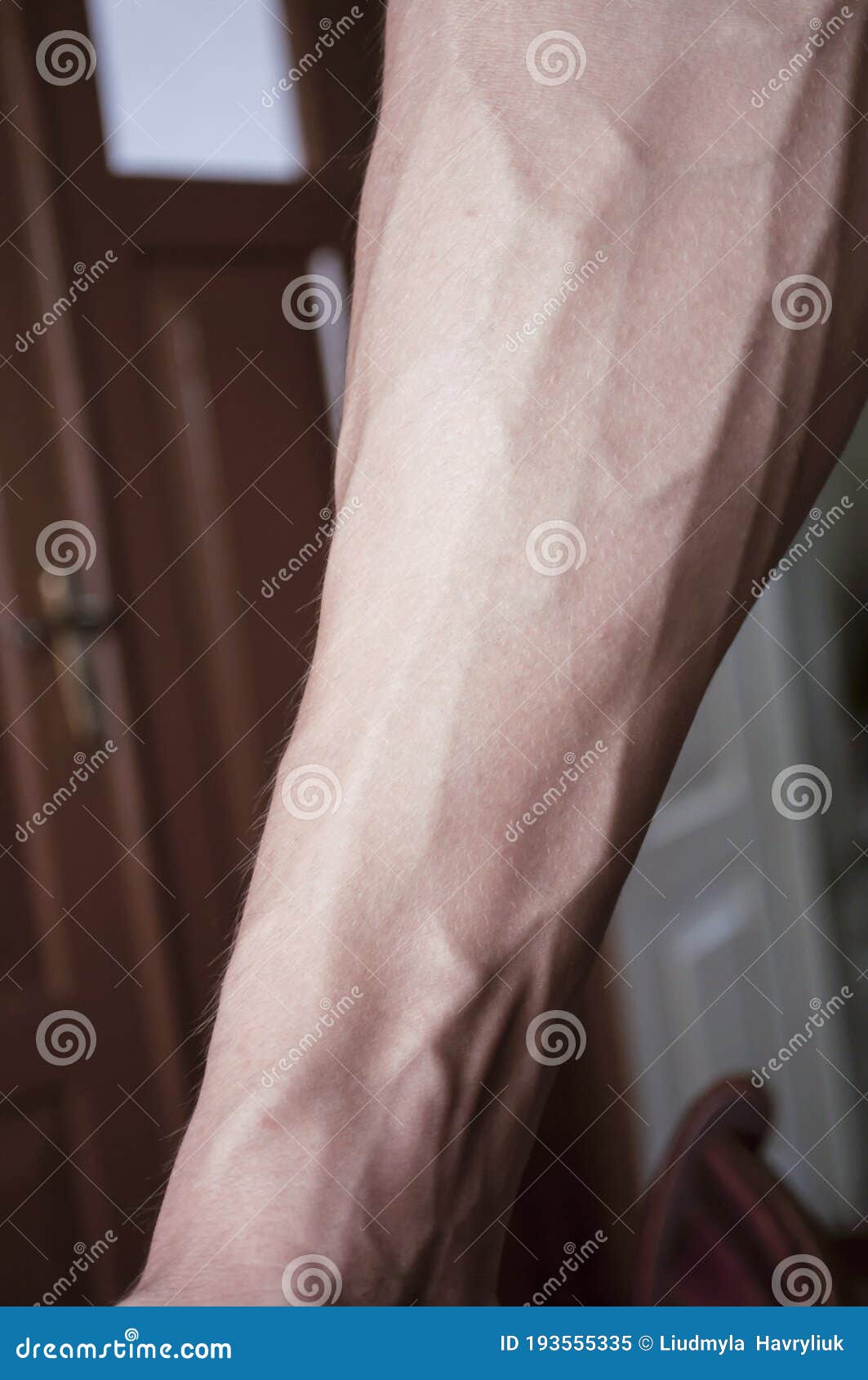 Convex Veins On The Arms Royalty-Free Stock Photo | CartoonDealer.com ...
