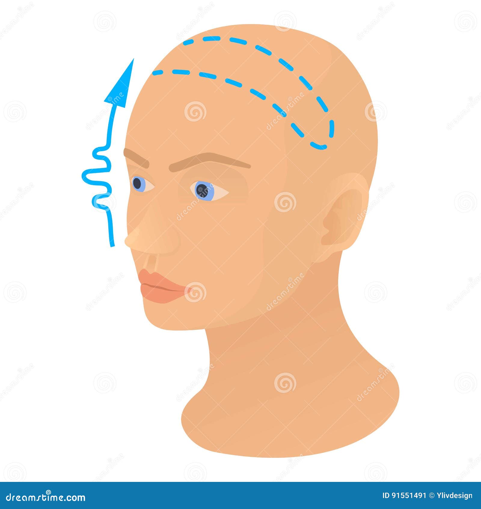 Forehead Lift Icon, Cartoon Style Stock Vector - Illustration of girl ...