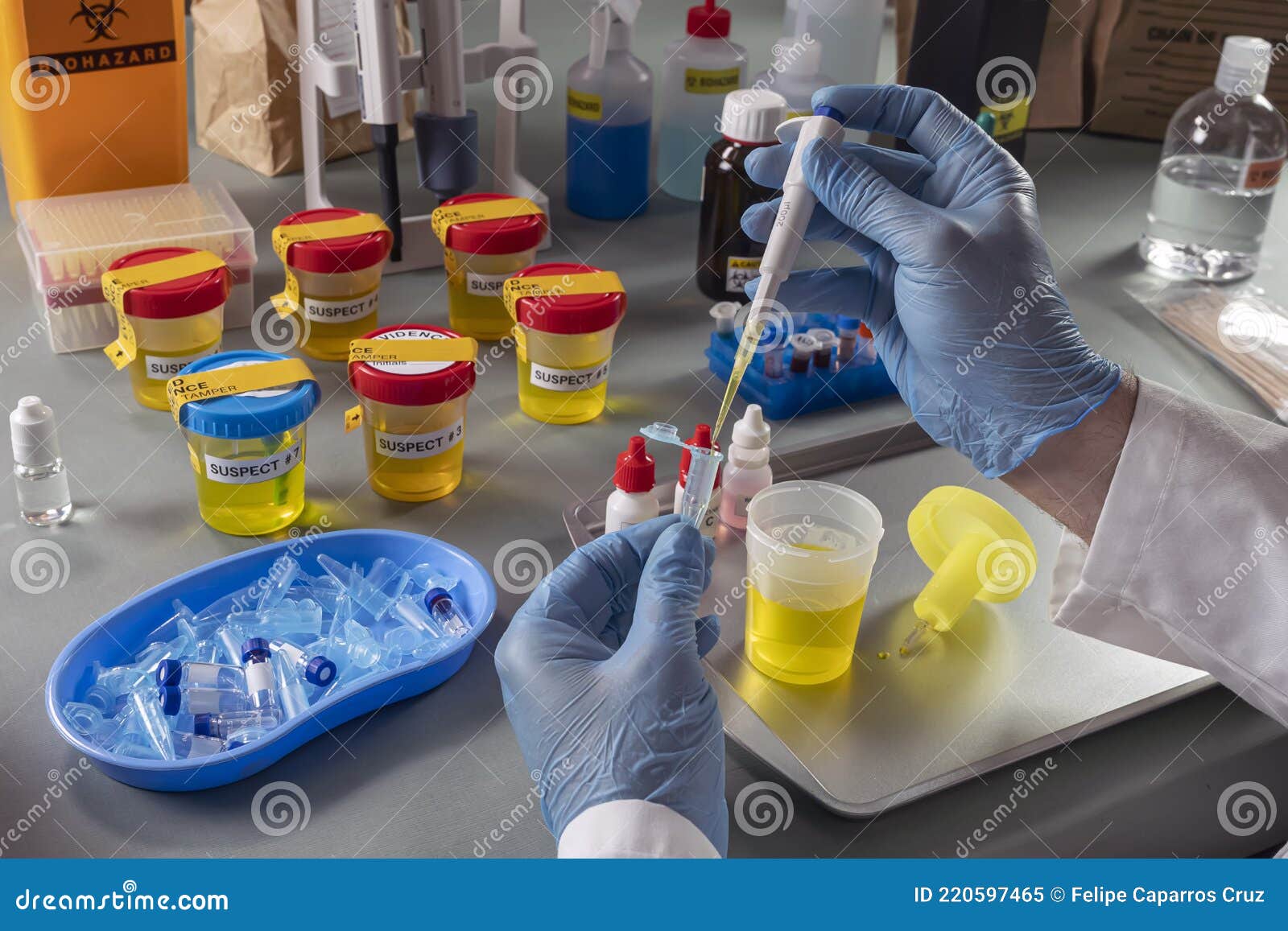 Containers With Urine Samples On Table In Laboratory Royalty-Free Stock ...