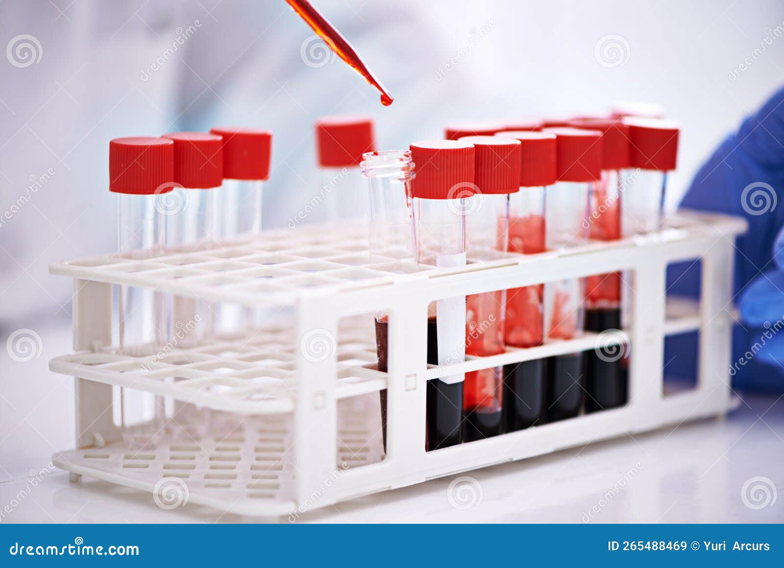 Forensic Science in Action. a Scientist Working with Blood Samples in ...