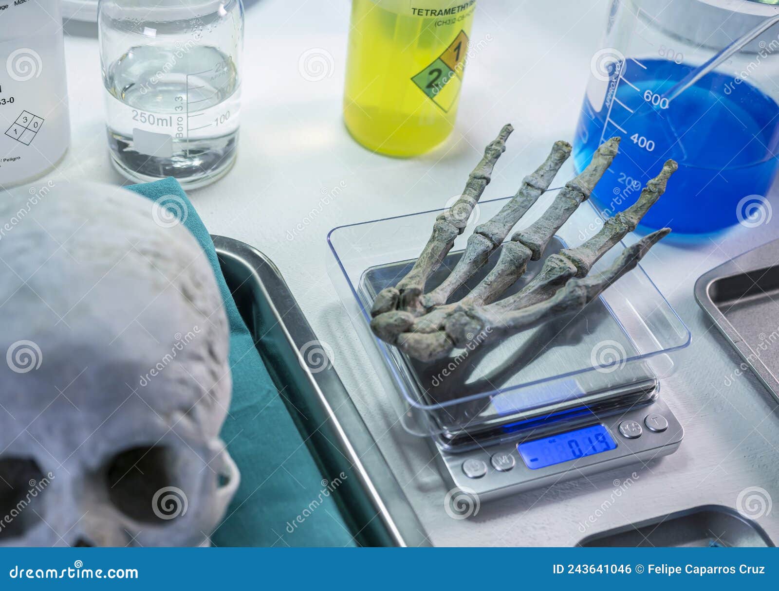 Forensic Scientist Weighs Right Hand of Human Skeleton on a Scale To ...