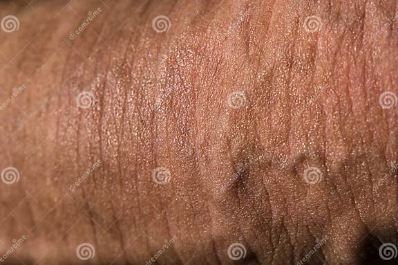 Foreskin Detail stock photo. Image of health, head, organ - 13689064