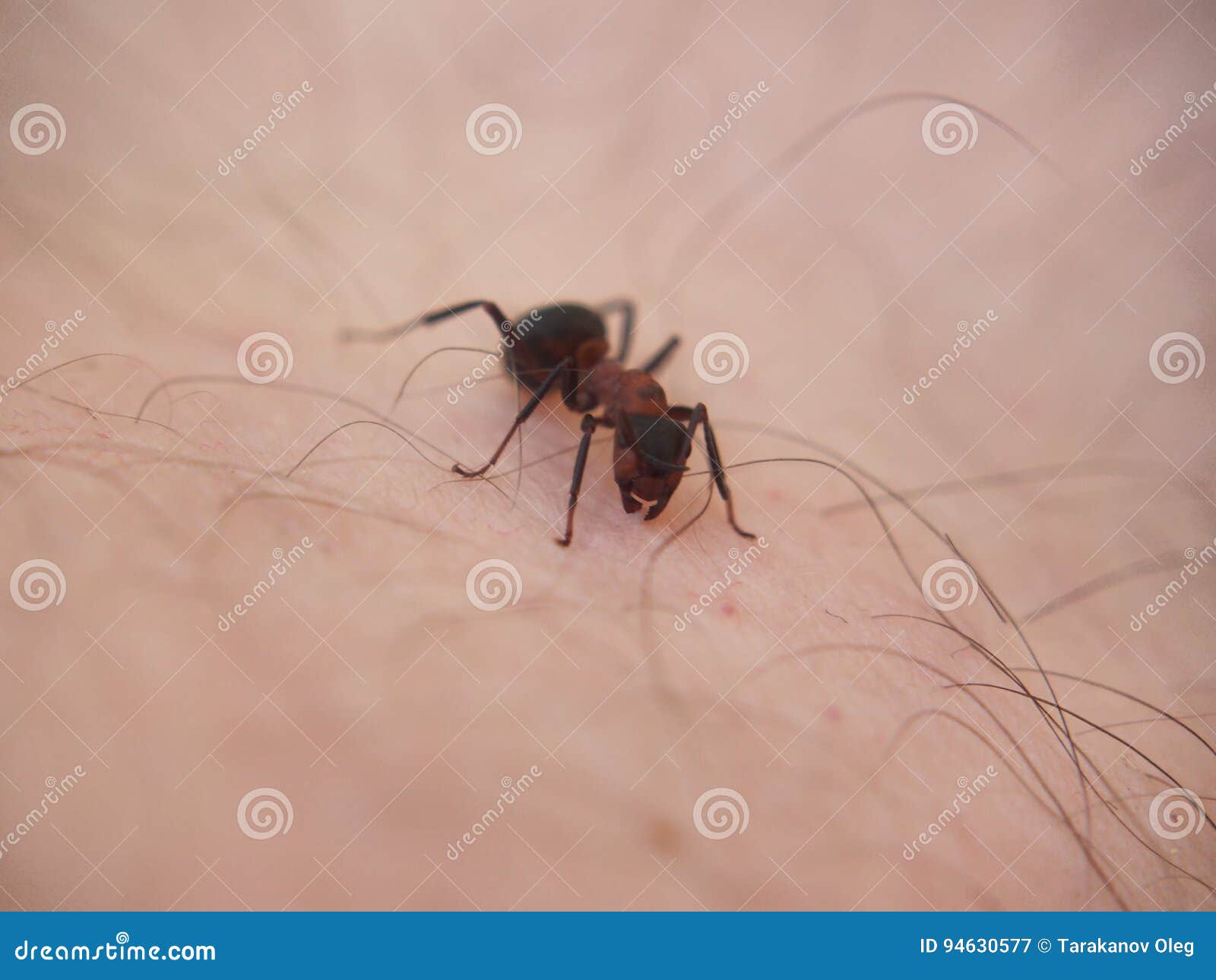 Forest Ant Sits on the Skin in Humans and Bites Him. Stock Image ...