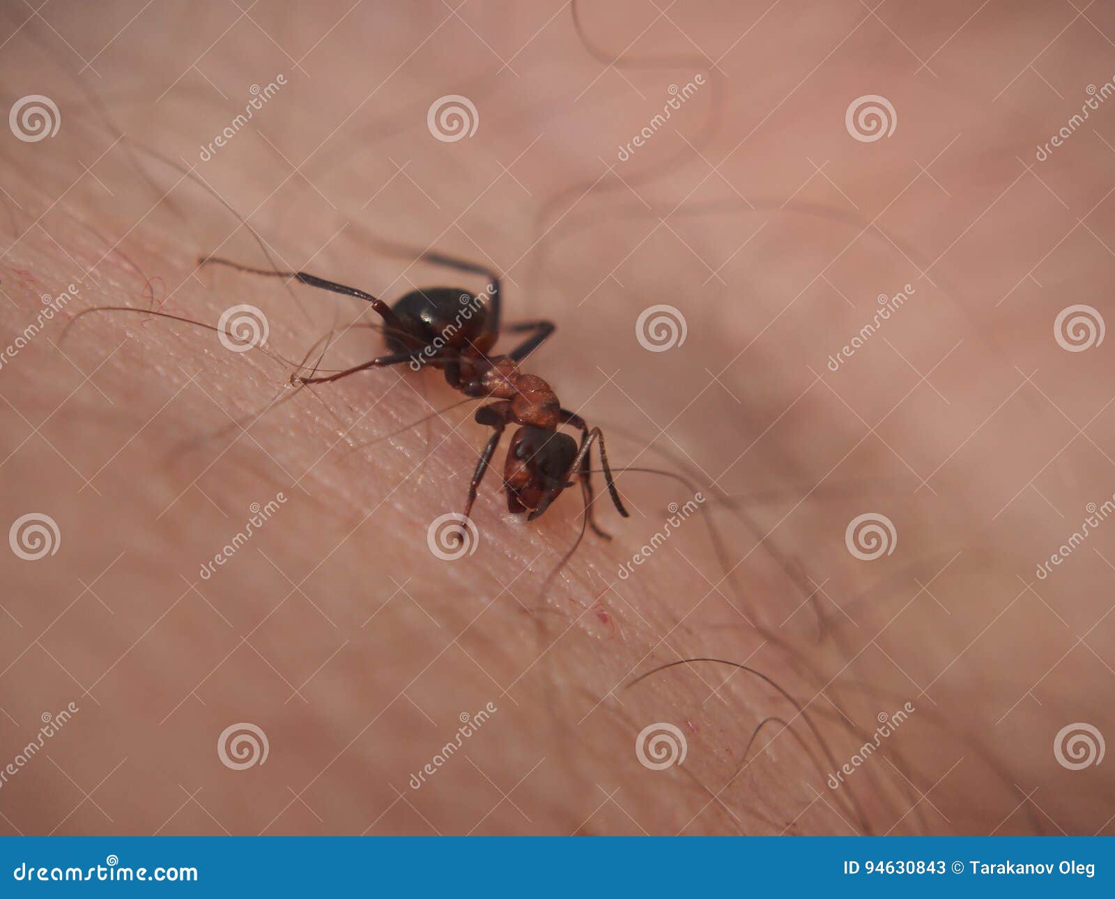 Forest Ant Sits on the Skin in Humans and Bites Him. Stock Image ...