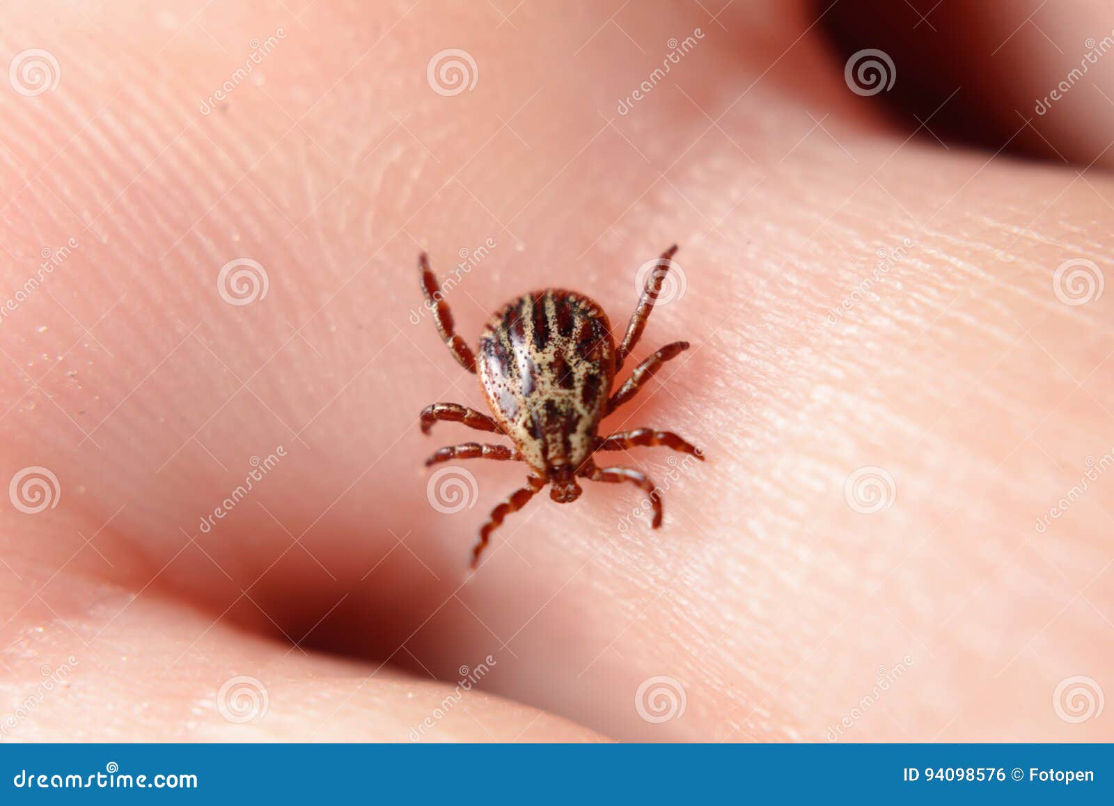 Wood Tick, Ixodes Ricinus, Specimen - Angled Side View, Isolated On ...