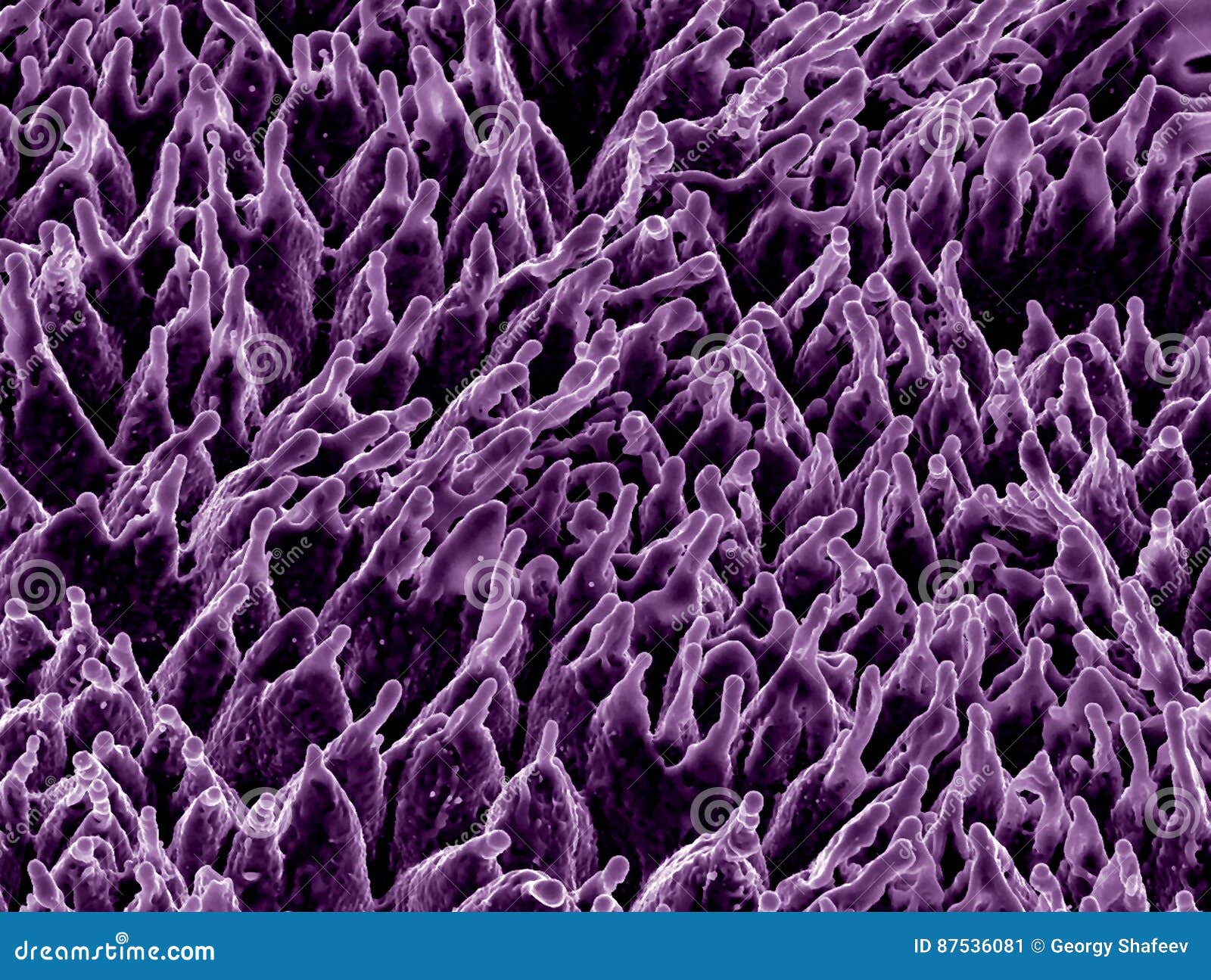 Nickel Micro-structures Produced By Multiple Laser Pulses Stock ...