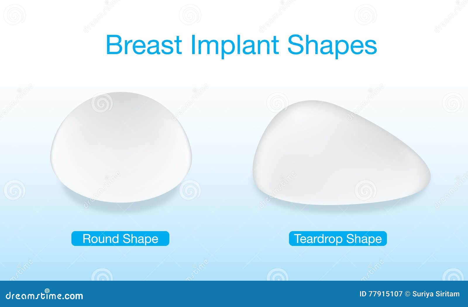 Formas Del Implante De Pecho Ilustración del Vector - Ilustración de ...