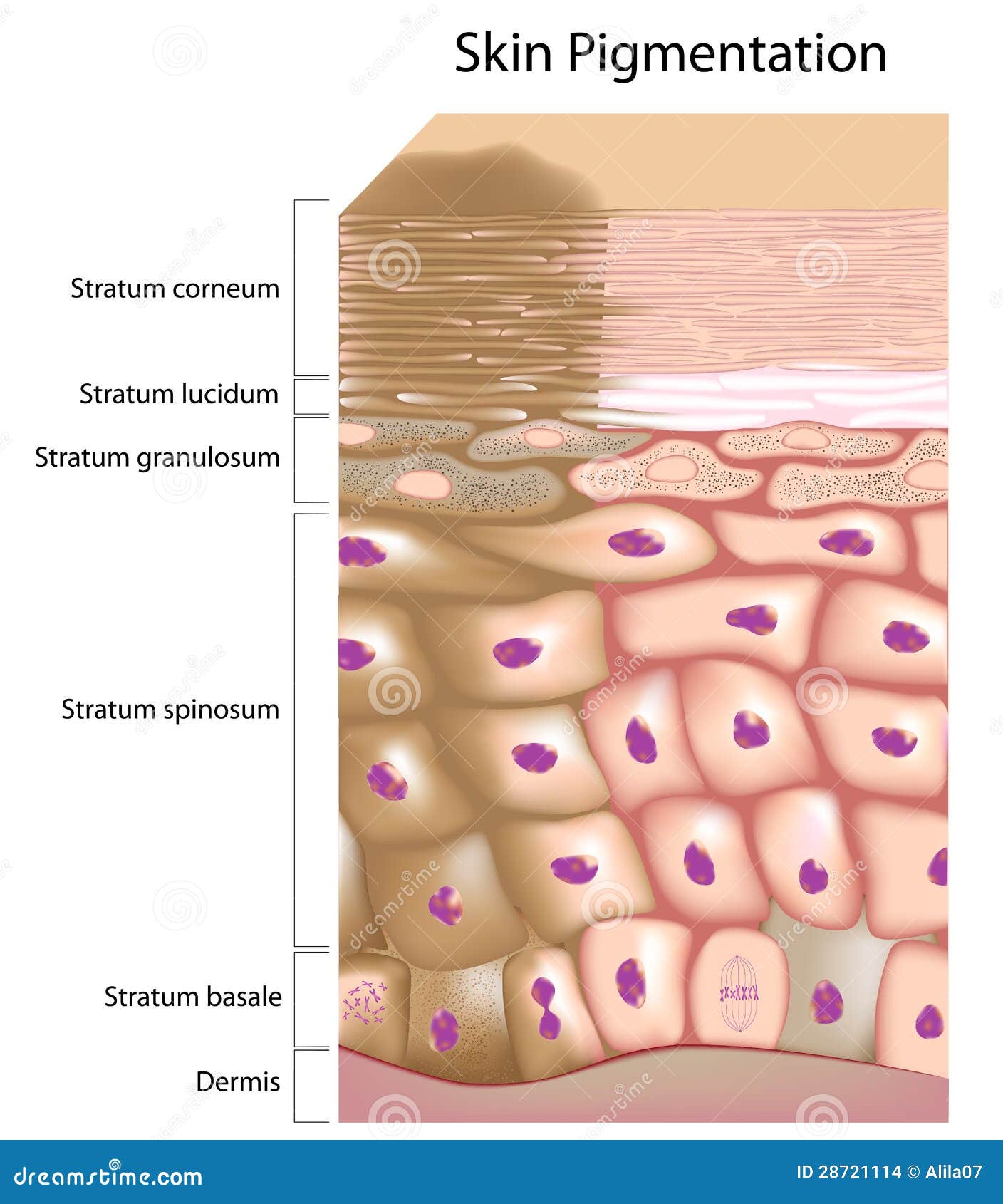 Formation of Uneven Skin Tone Stock Vector - Illustration of care ...