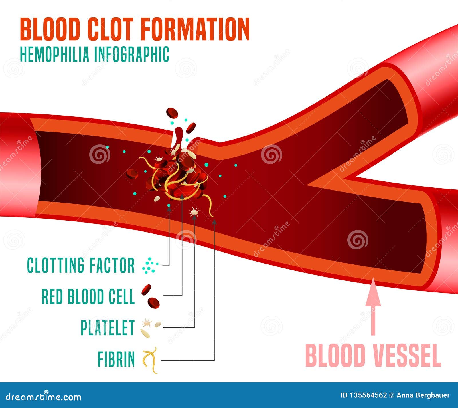 Formazione Del Coagulo Di Sangue Illustrazione Vettoriale ...