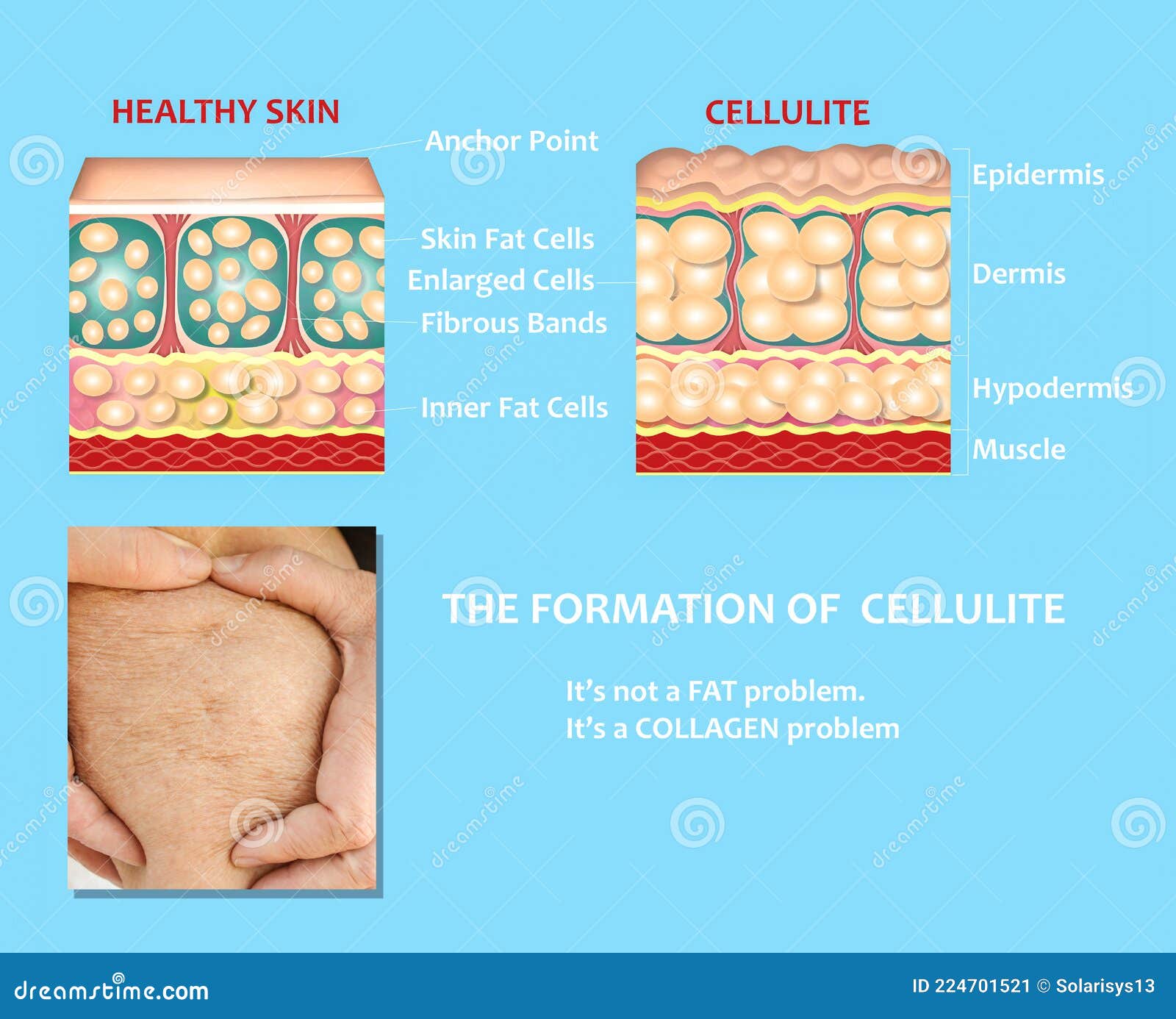 Illustration Of The Structure Stock Photography | CartoonDealer.com ...