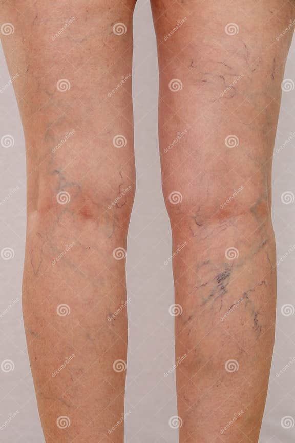 Foto Delle Gambe Di Una Donna Anziana in Mutandine Bianche Con Le ... Foto Delle Gambe Di Una Donna Anziana in Mutandine Bianche Con Le ...