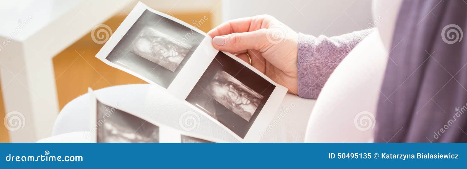 Fotos de Usg imagen de archivo. Imagen de color, médico - 50495135