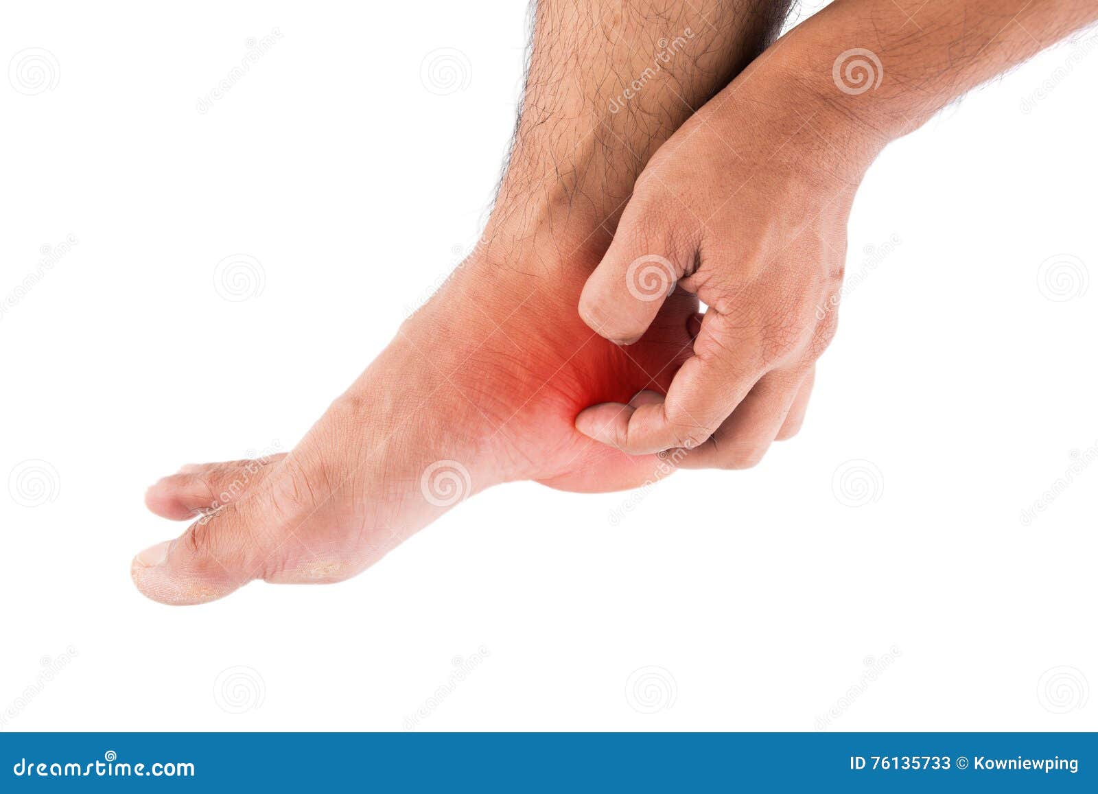 Fotsvamp fotografering för bildbyråer. Bild av bakgrund - 76135733