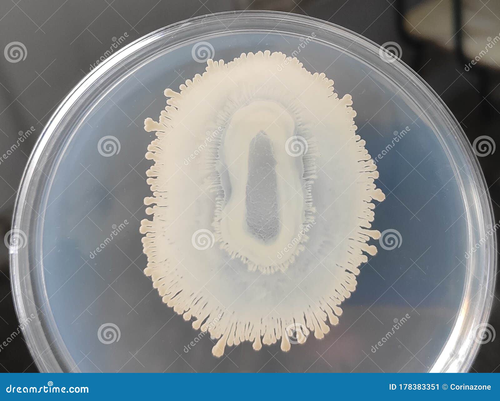 A Fractal Pattern Bacterial Colony in a Petri Plate Dish with Nutrient ...
