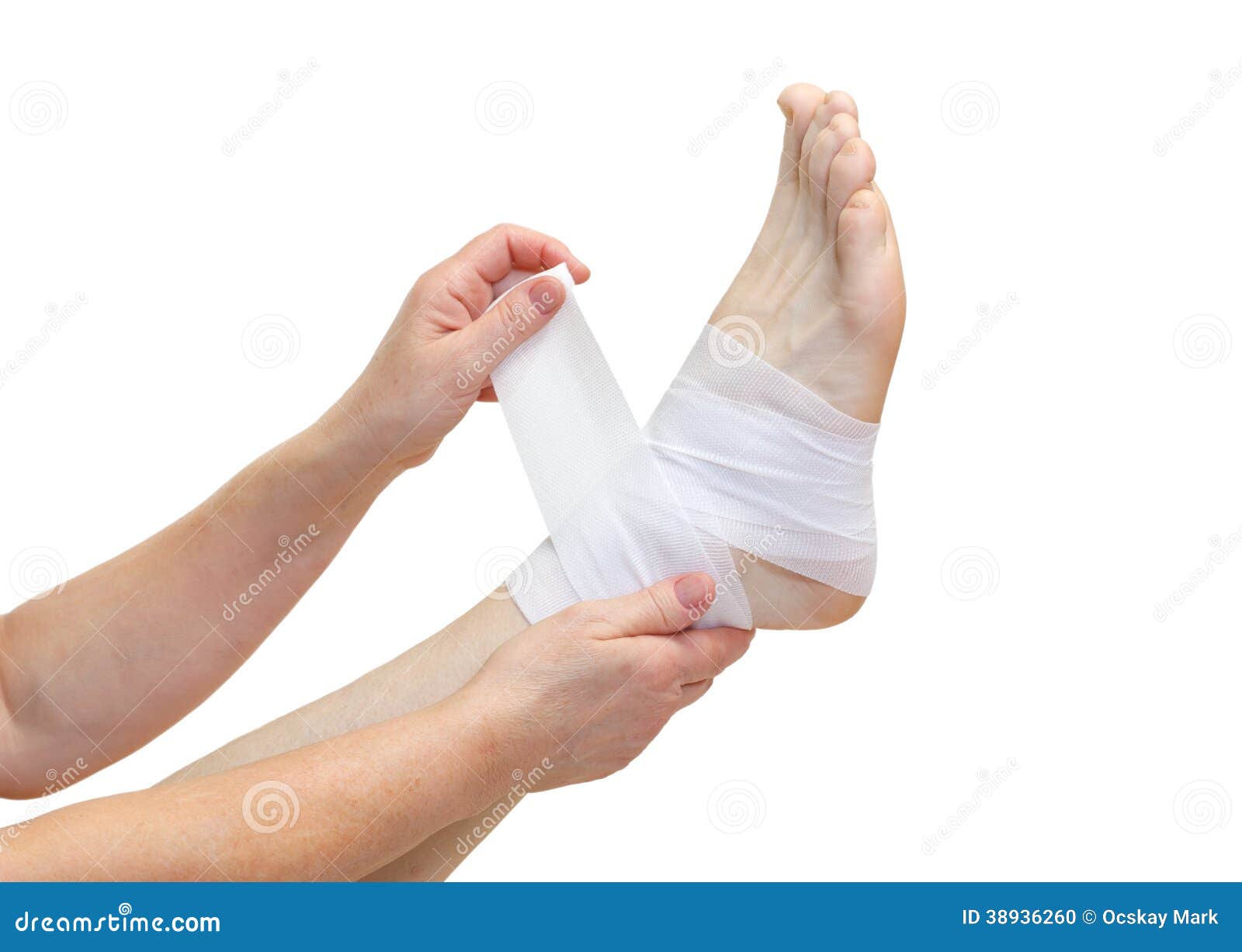 Fracture de cheville photo stock. Image du blessures - 38936260