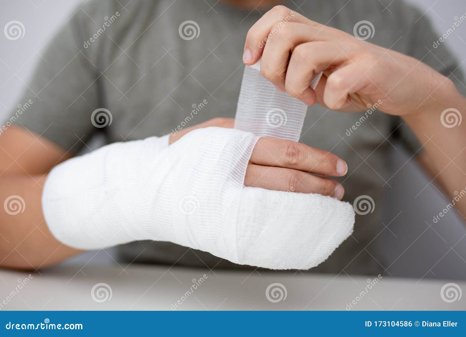 Fracture and First Aid Concept - Close Up of Man Bandaging Himself ...