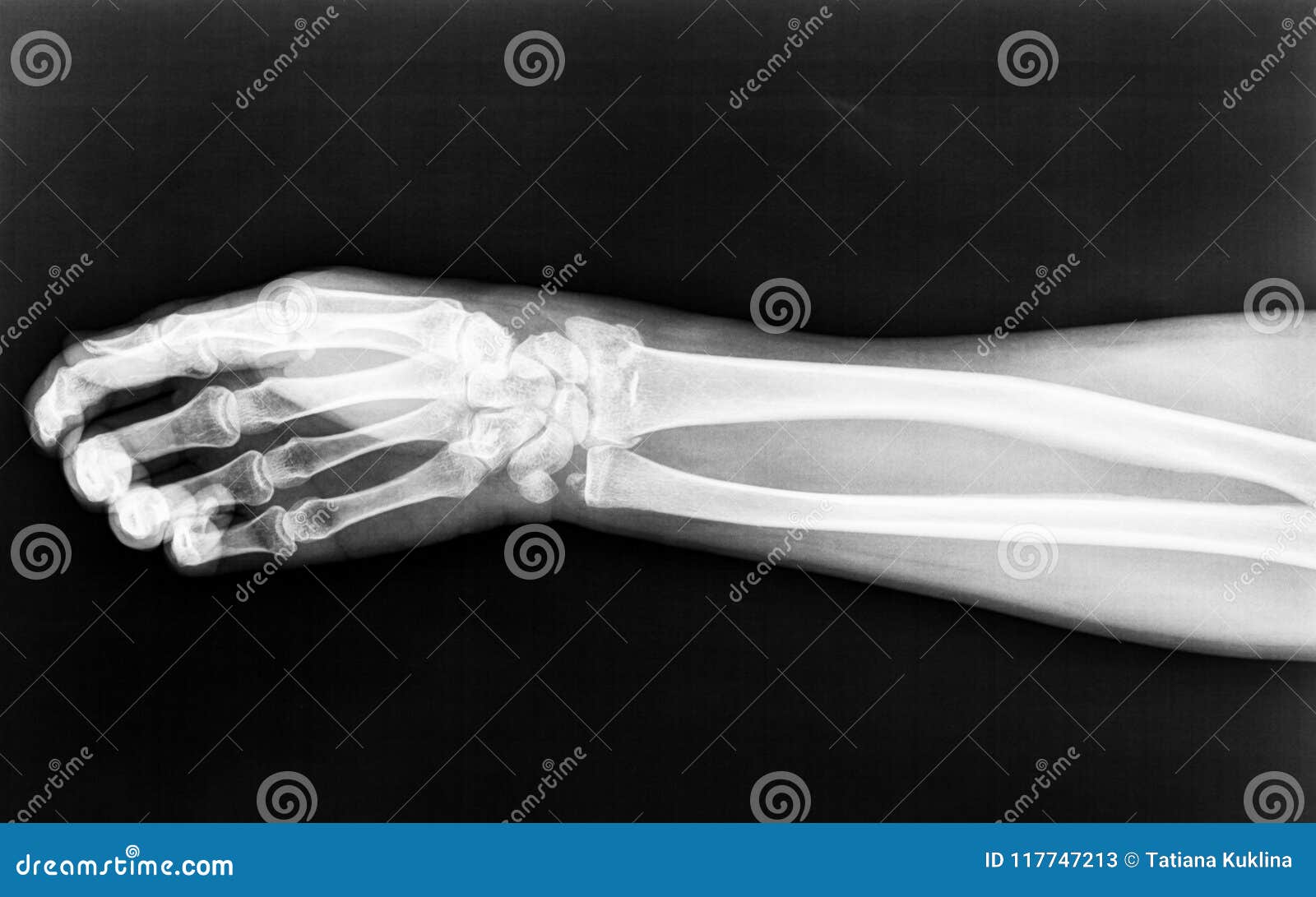 Radius Transparent Stock Photos - Free & Royalty-Free Stock Photos from ...