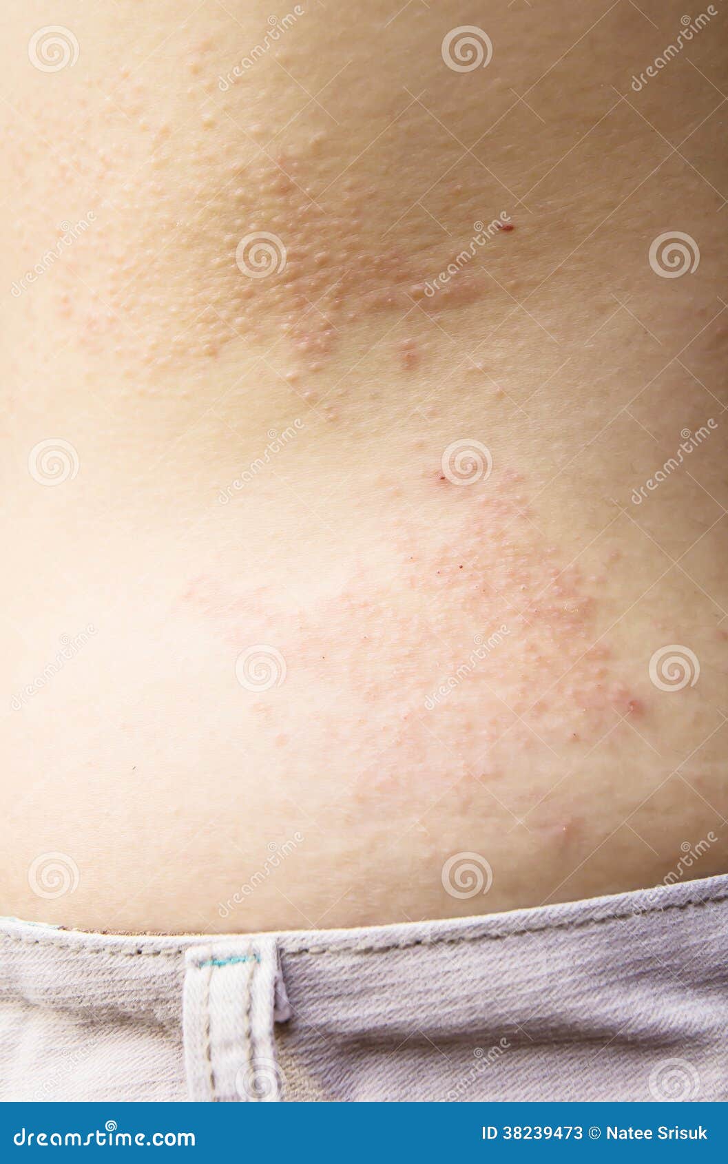 Fragrance allergies stock image. Image of people, scratch - 38239473