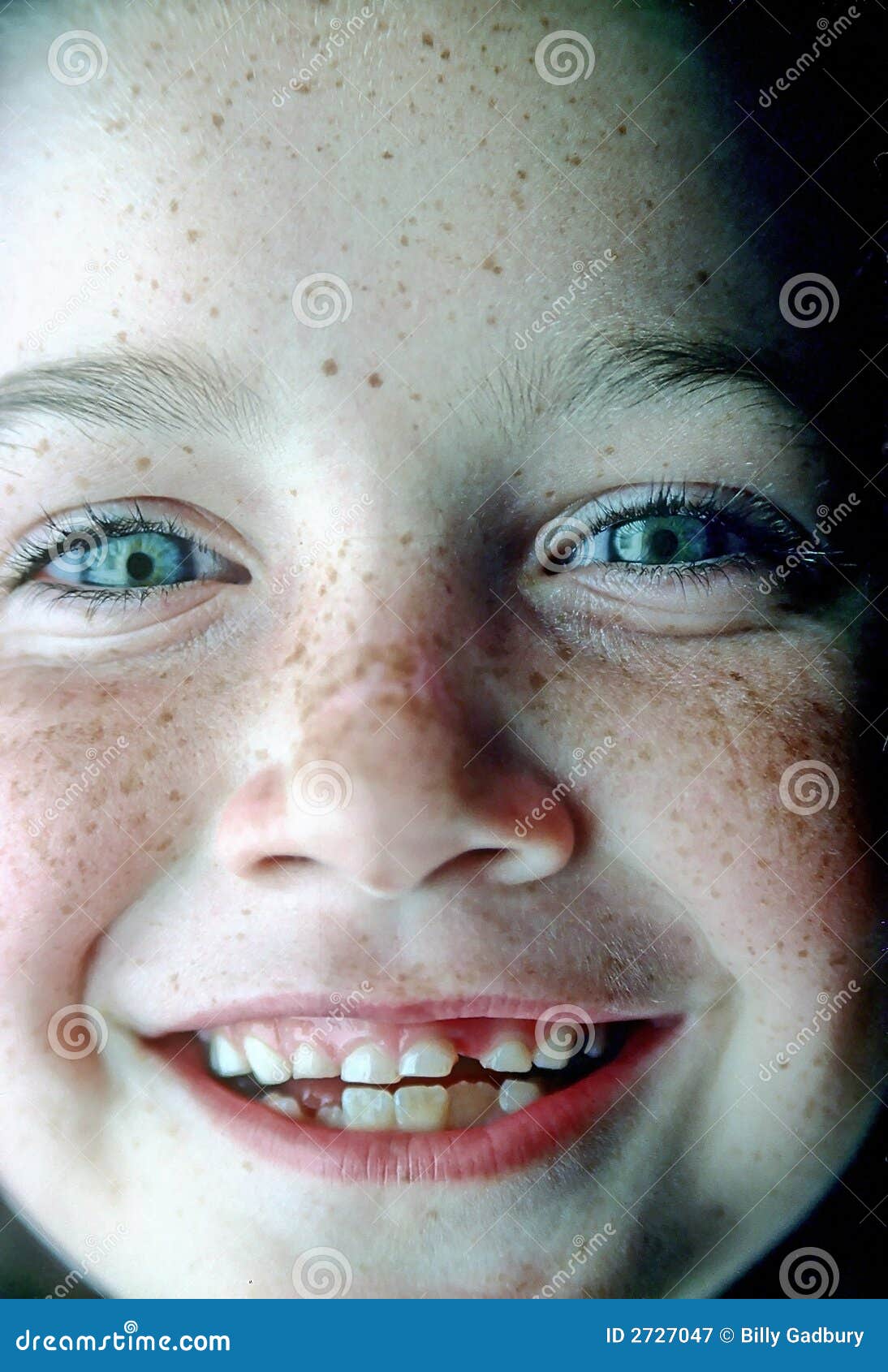 Freckle Face Royalty Free Stock Photography - Image: 2727047