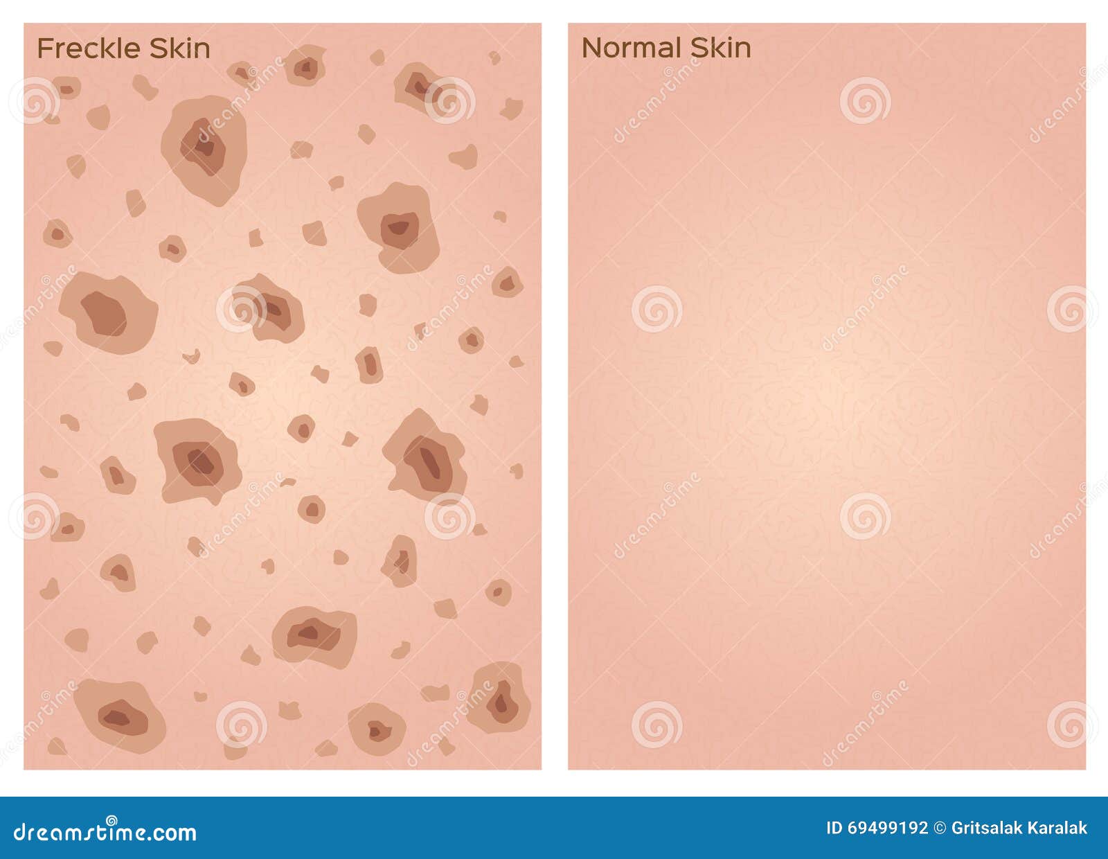 Freckle Skin Texture Graphic , Vector , Nice Skin | CartoonDealer.com ...