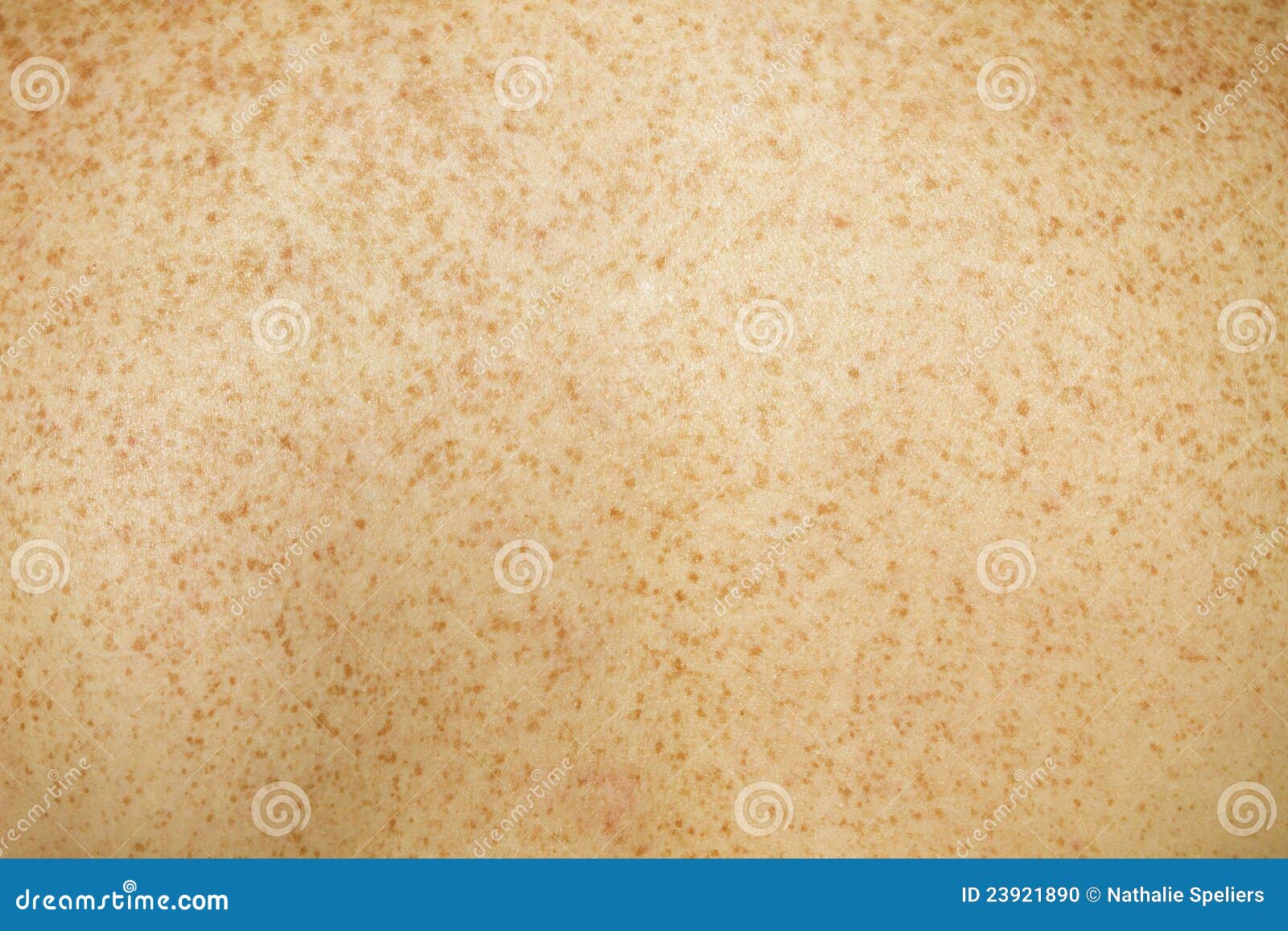 Freckled Back Skin stock photo. Image of back, clusters - 23921890
