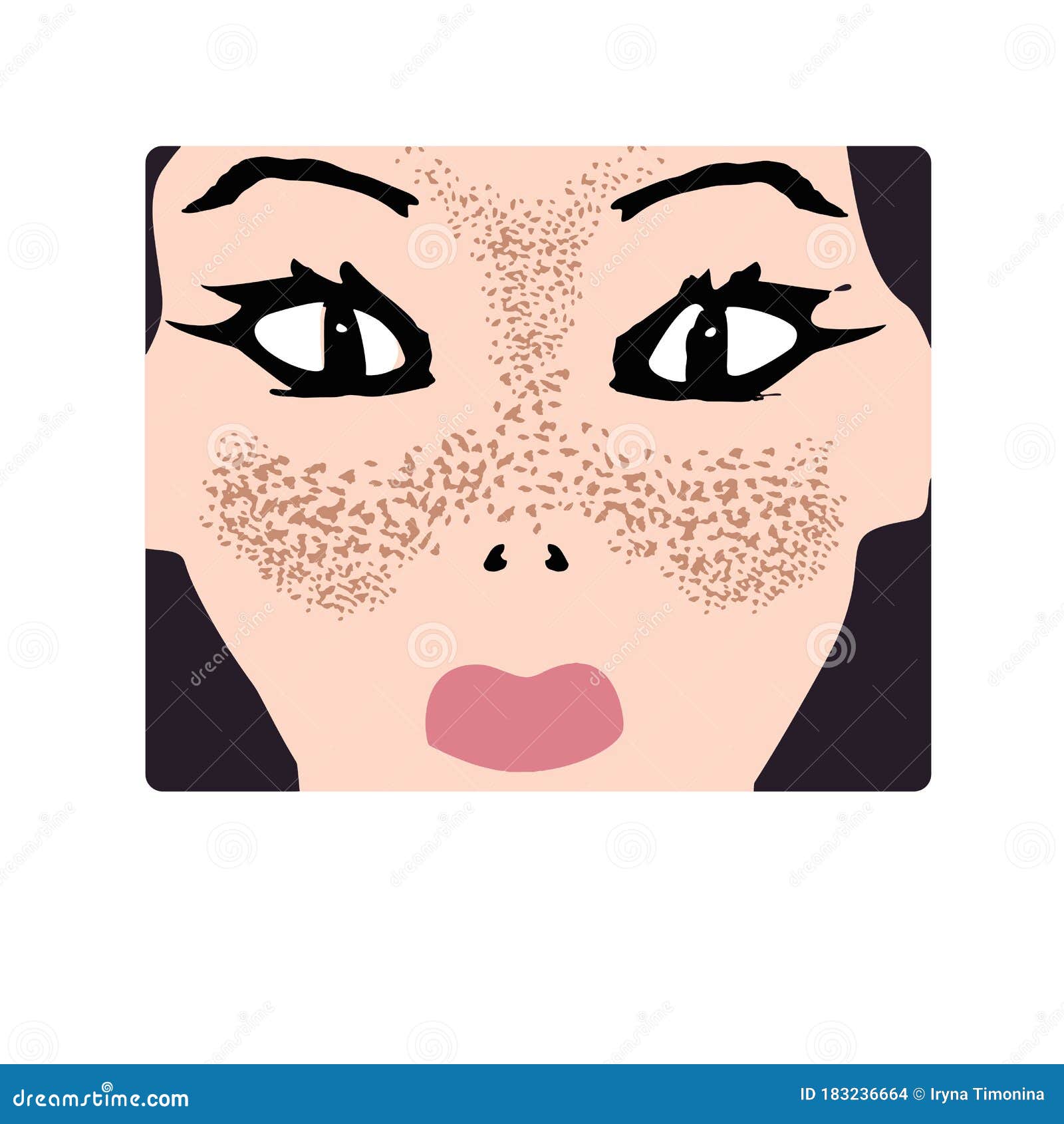 Freckles On The Face. Pigmentation On The Skin. A Pigmented Spot On The ...