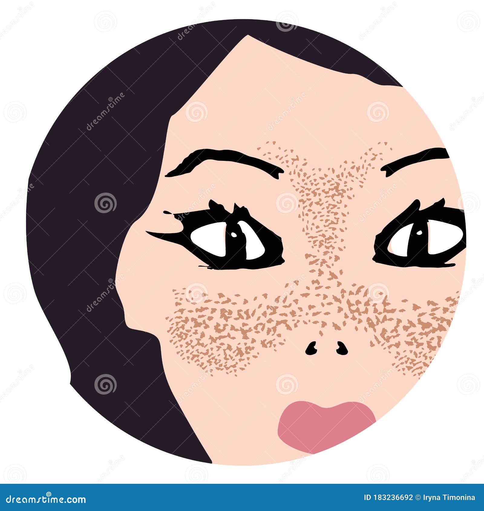 Freckles on the Face. Pigmentation on the Skin. a Pigmented Spot on the ...