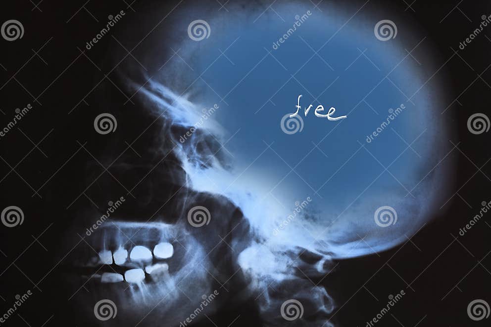 Free Memory stock photo. Image of inside, graphic, anatomy - 32599022