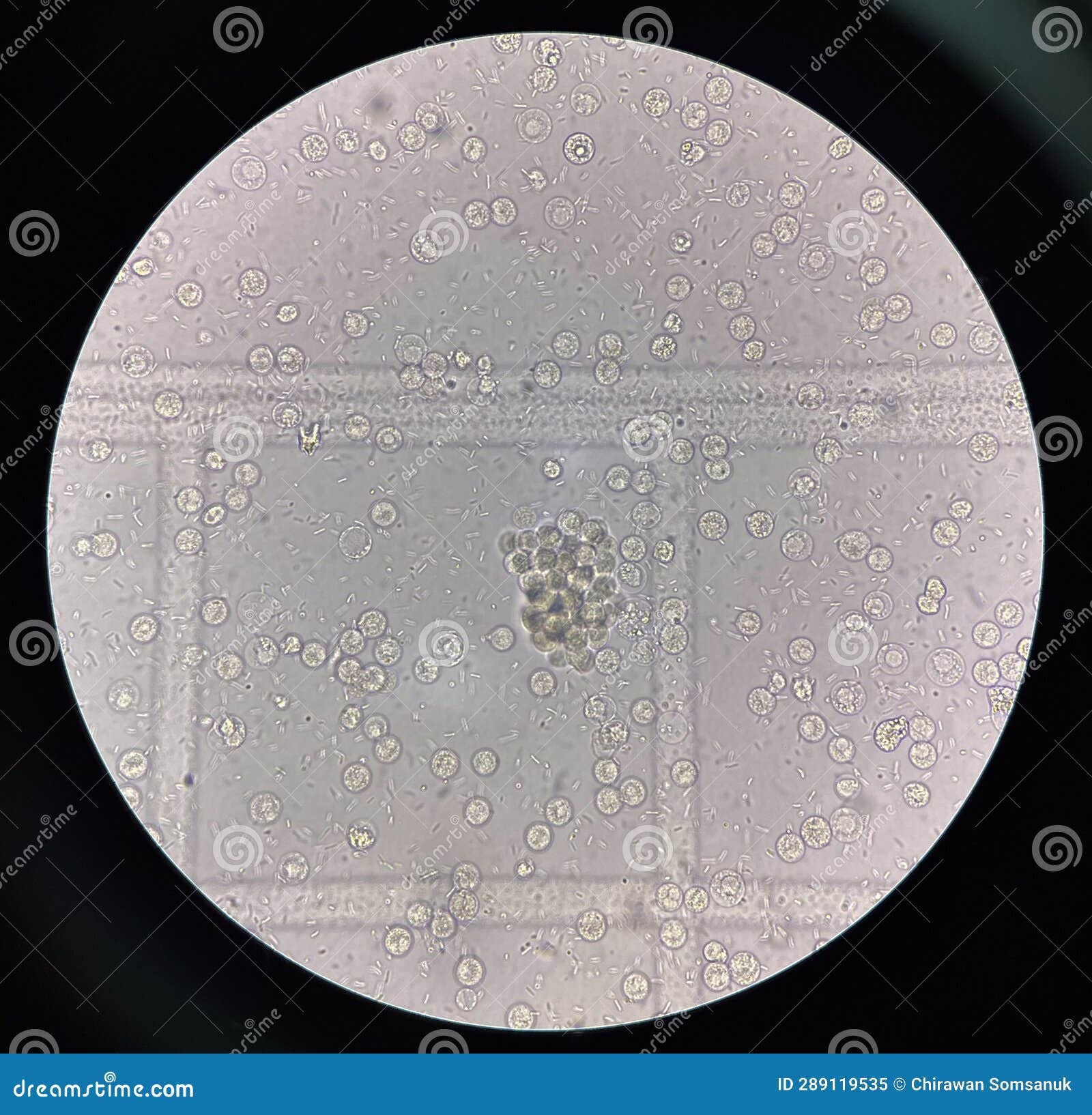 Fresh Bacteria Cell in Urine Sample Stock Image - Image of epidemic ...