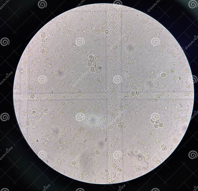 Fresh Bacteria Cell in Urine Sample Stock Photo - Image of bacillus ...