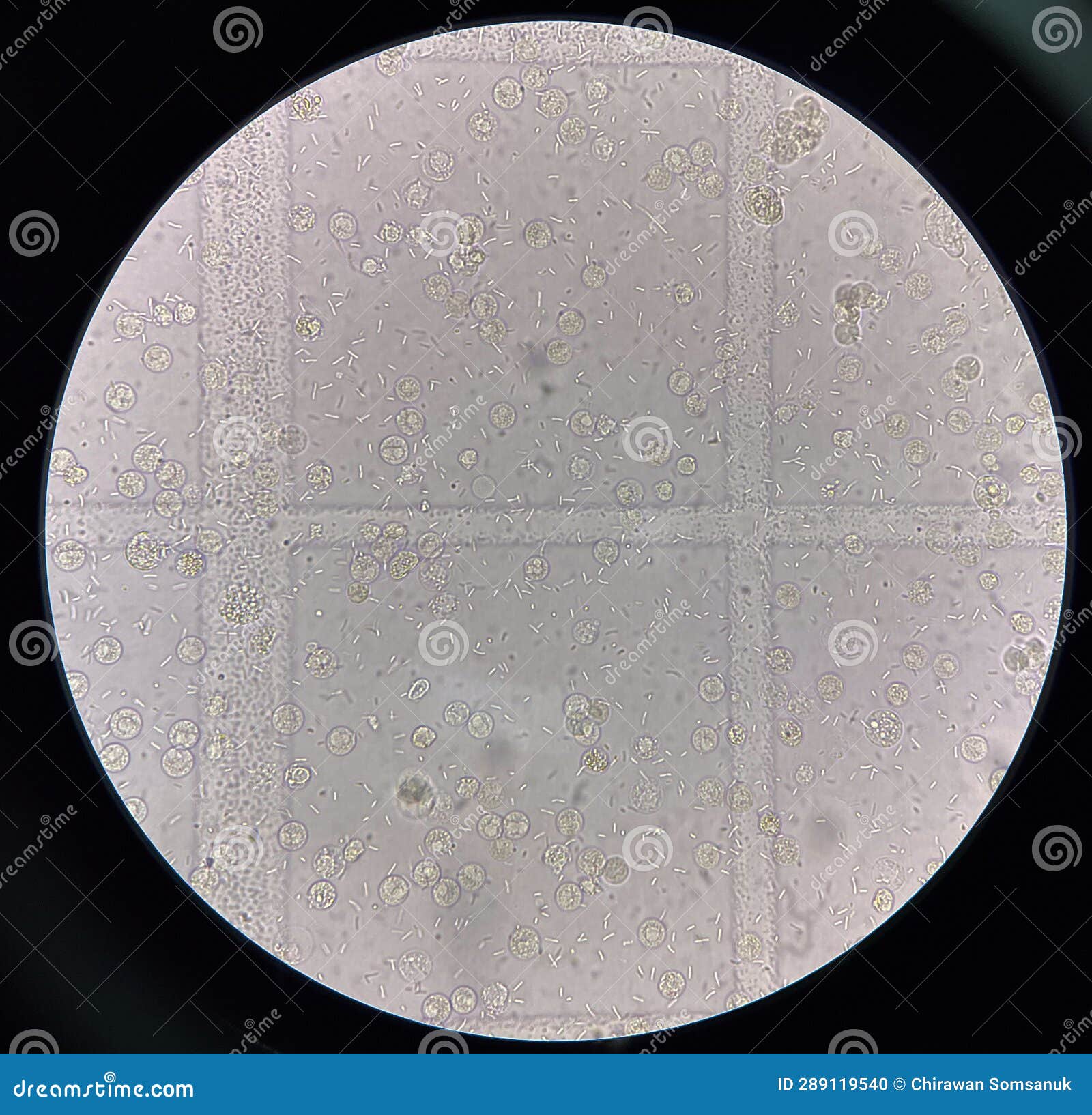 Fresh Bacteria Cell in Urine Sample Stock Photo - Image of bacterium ...