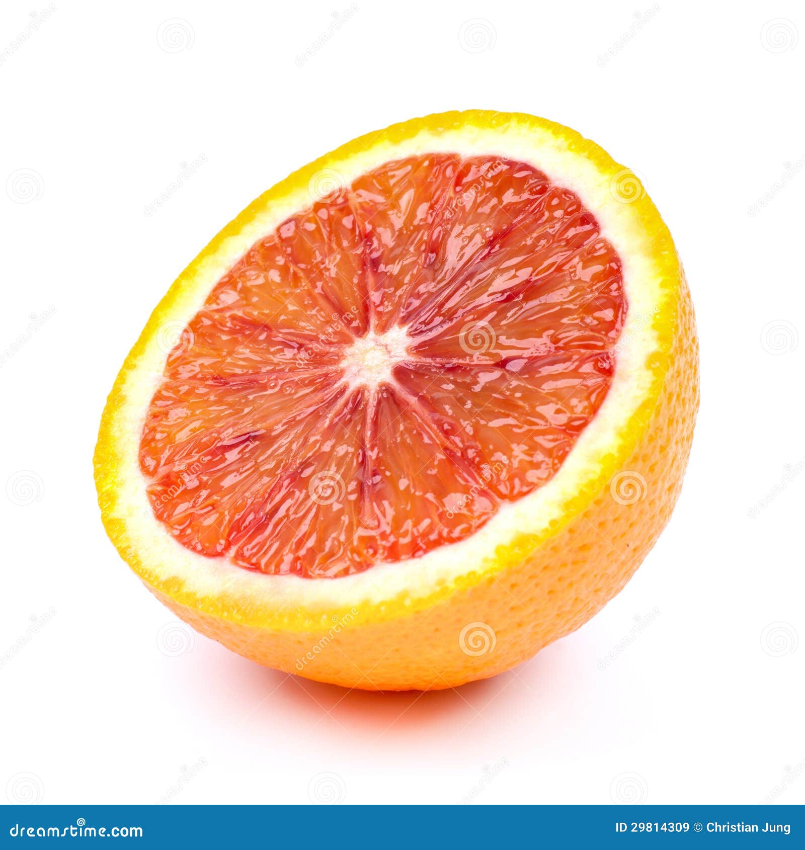 Fresh Red Blood Cells In Urine Sample. Royalty-Free Stock Image ...