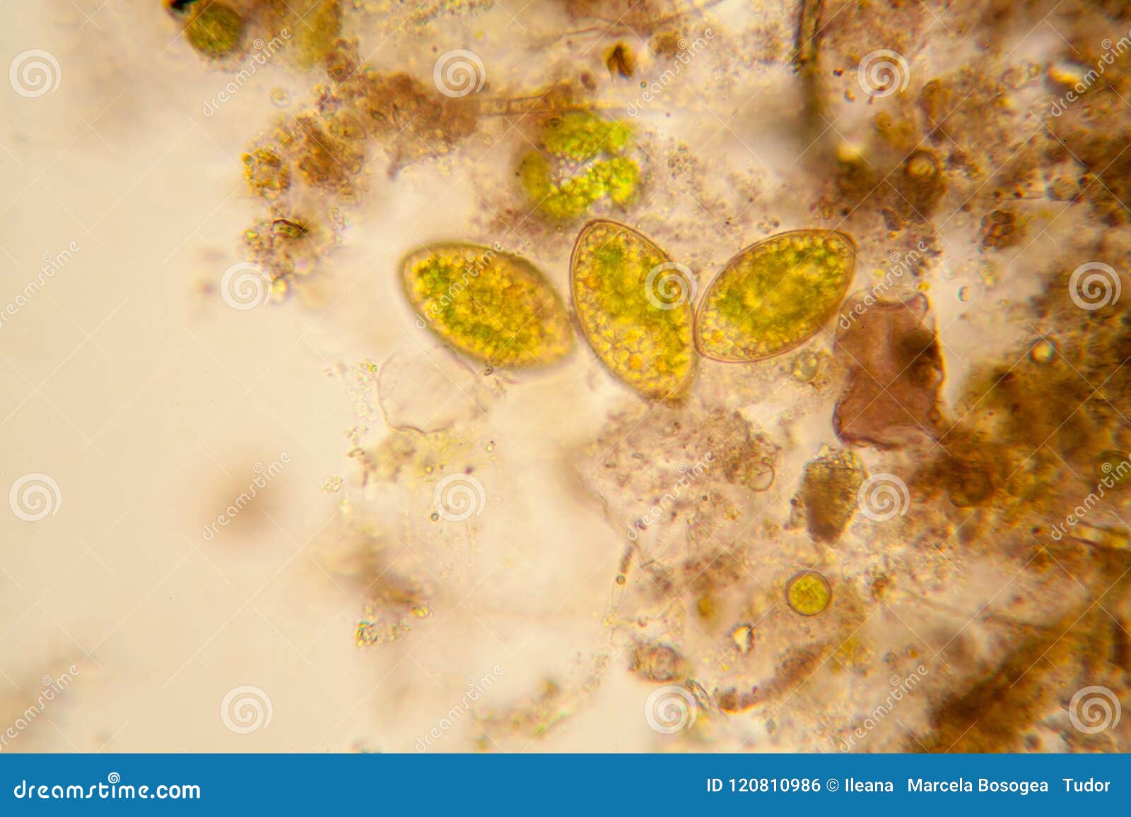 Pond Water Plankton and Algae at the Microscope Stock Photo - Image of ...