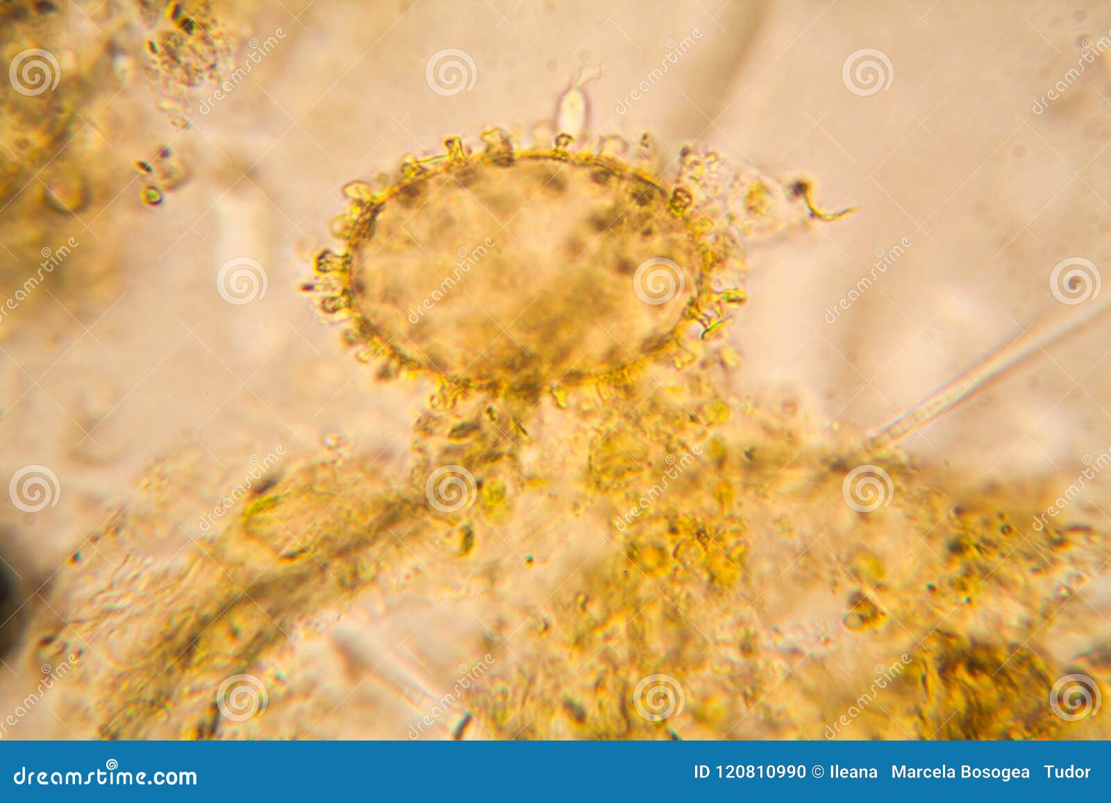 Pond Water Plankton and Algae at the Microscope Stock Photo - Image of ...