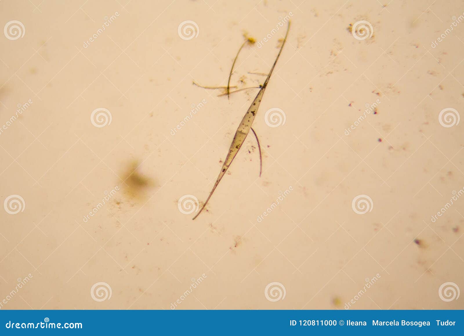Pond Water Plankton and Algae at the Microscope Stock Photo - Image of ...