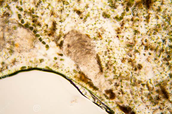 Fresh Pond Water Plankton and Algae at the Microscope. Copepod Stock ...