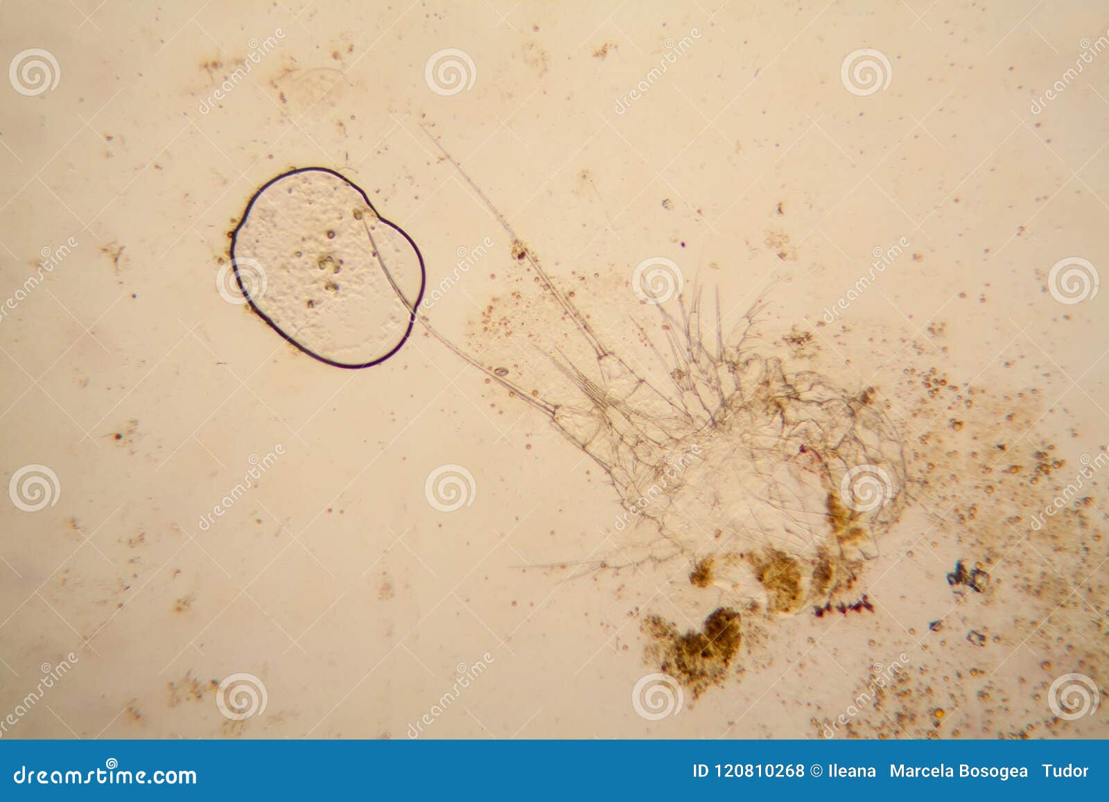 Fresh Pond Water Plankton and Algae at the Microscope. Copepod Stock ...