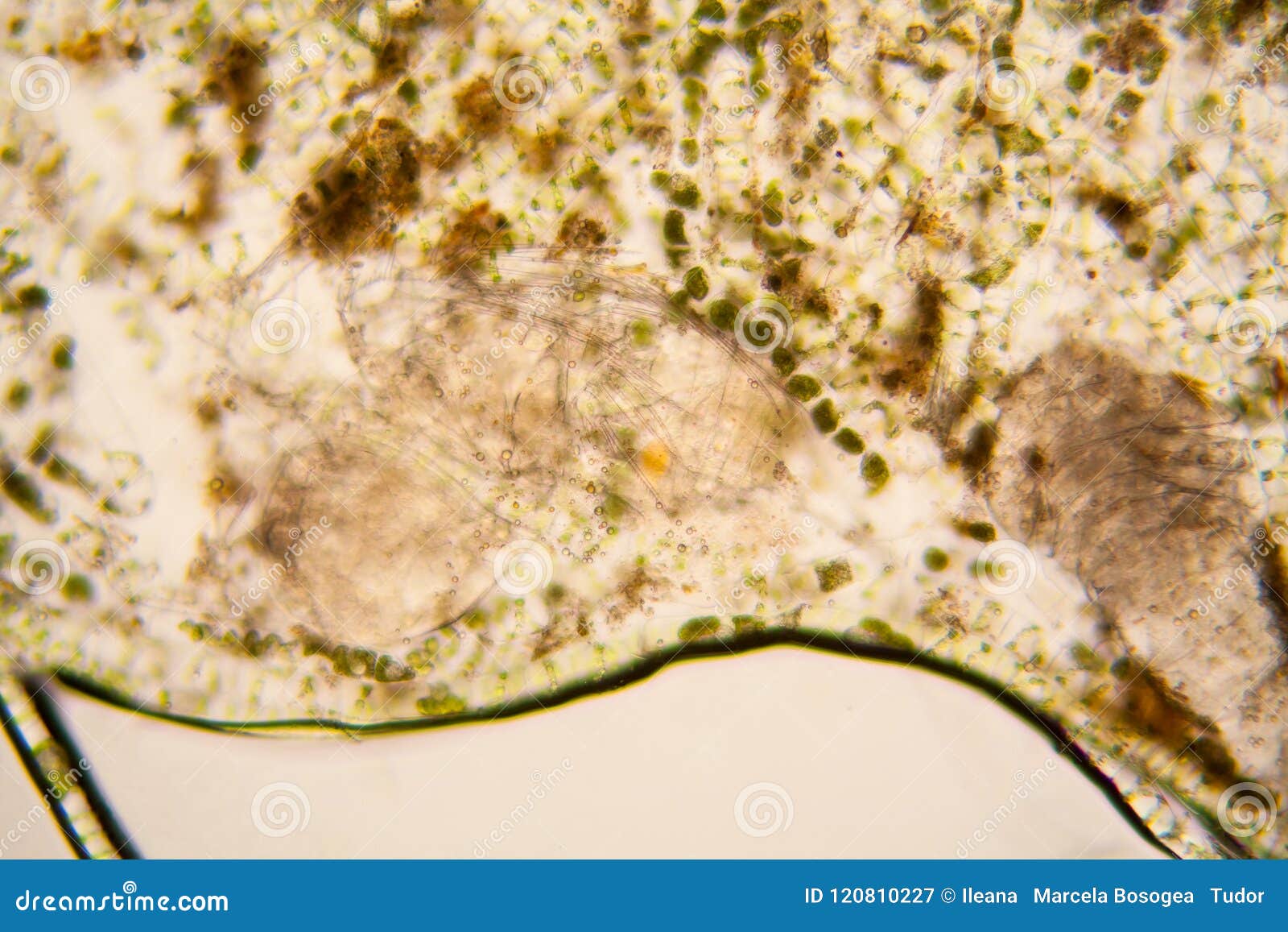 Fresh Pond Water Plankton and Algae at the Microscope. Copepod Stock ...