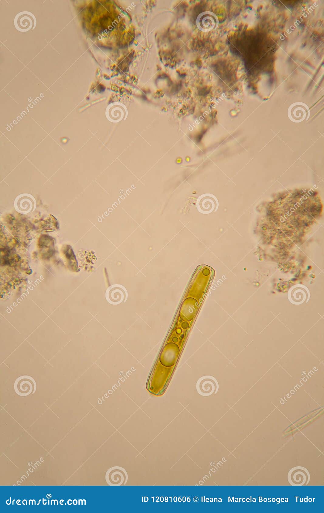 Pond Water Plankton and Algae at the Microscope. Diatoms Stock Photo ...