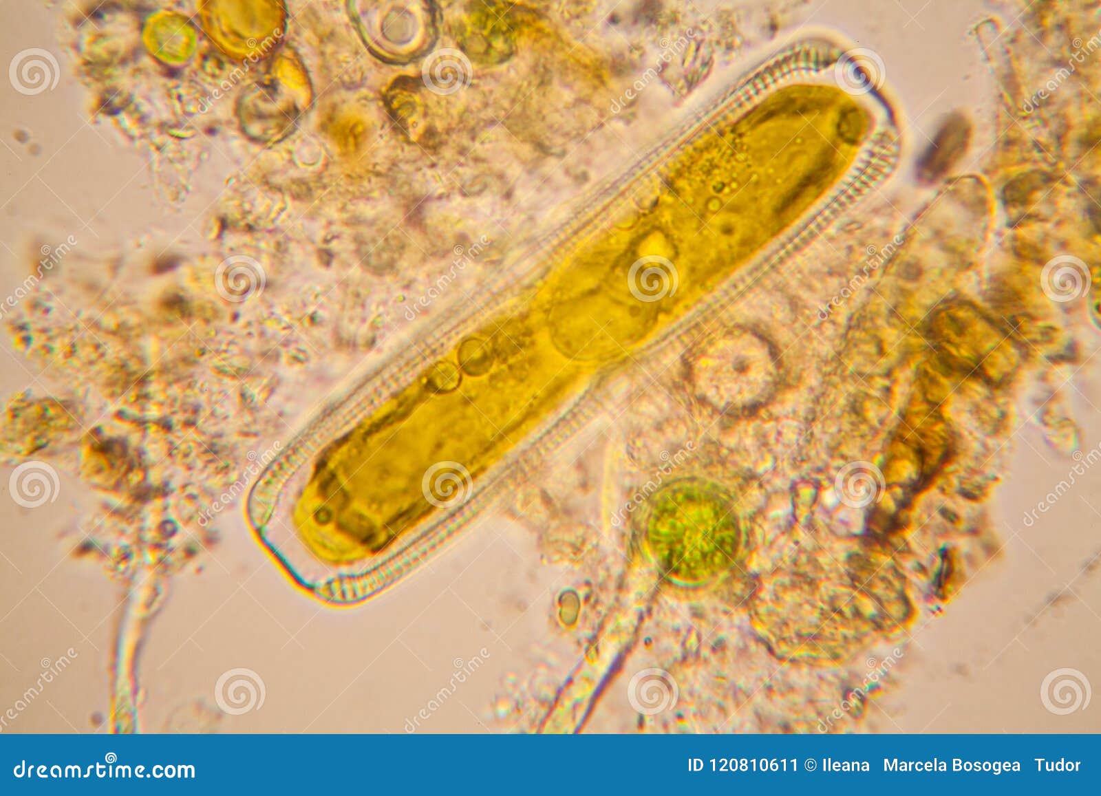 Pond Water Plankton and Algae at the Microscope. Diatoms Stock Image ...