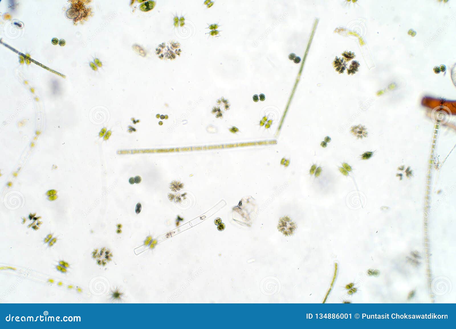 Freshwater Aquatic Plankton Under Microscope View Stock Image - Image ...